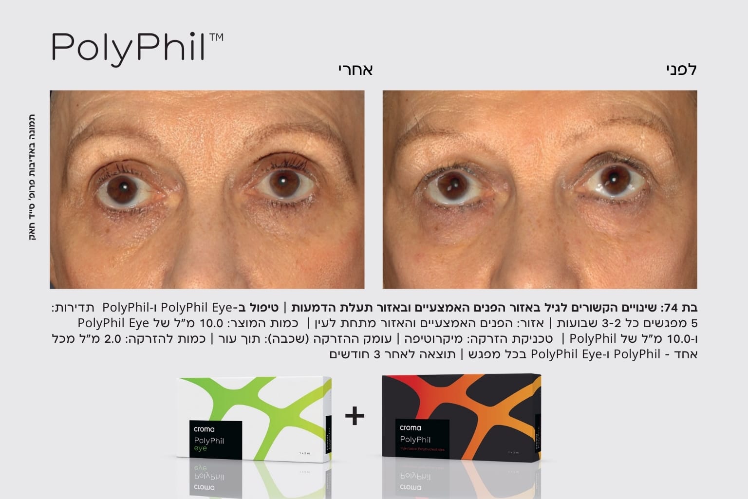 סדרת הפולינוקלאוטידים להזרקה פוליפיל PolyPhil™